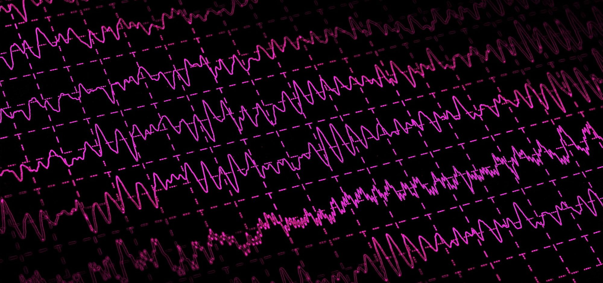 Conoce las ventajas del ruido rosa - WeMystic